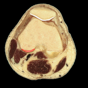 ANATOMIA DE LA RODILLA