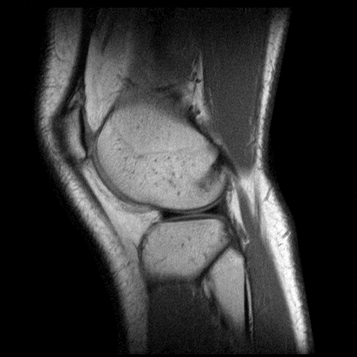 ANATOMIA DE LA RODILLA