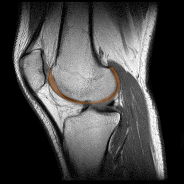 ANATOMIA DE LA RODILLA