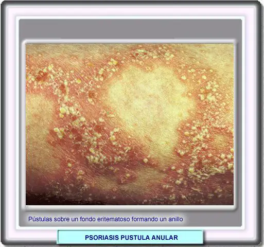Atlas De Dermatologia