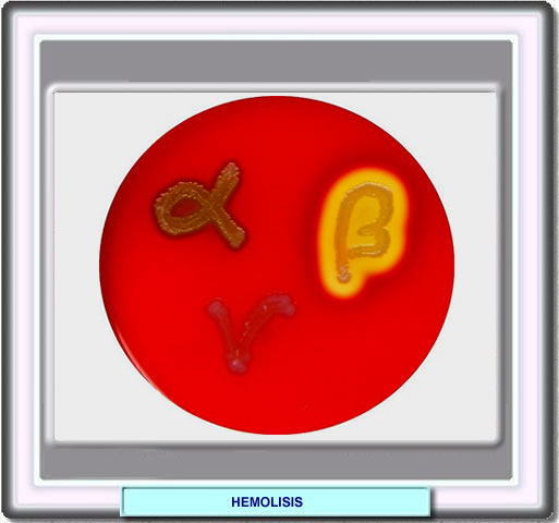 Hemólisis