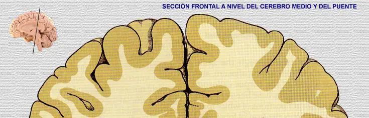 brain001.jpg
